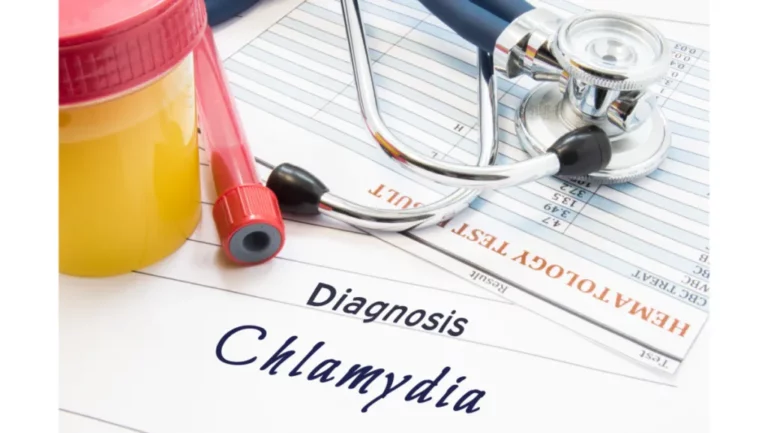 Private STI Tests in Nigeria: Options, Importance & Understanding Costs ...